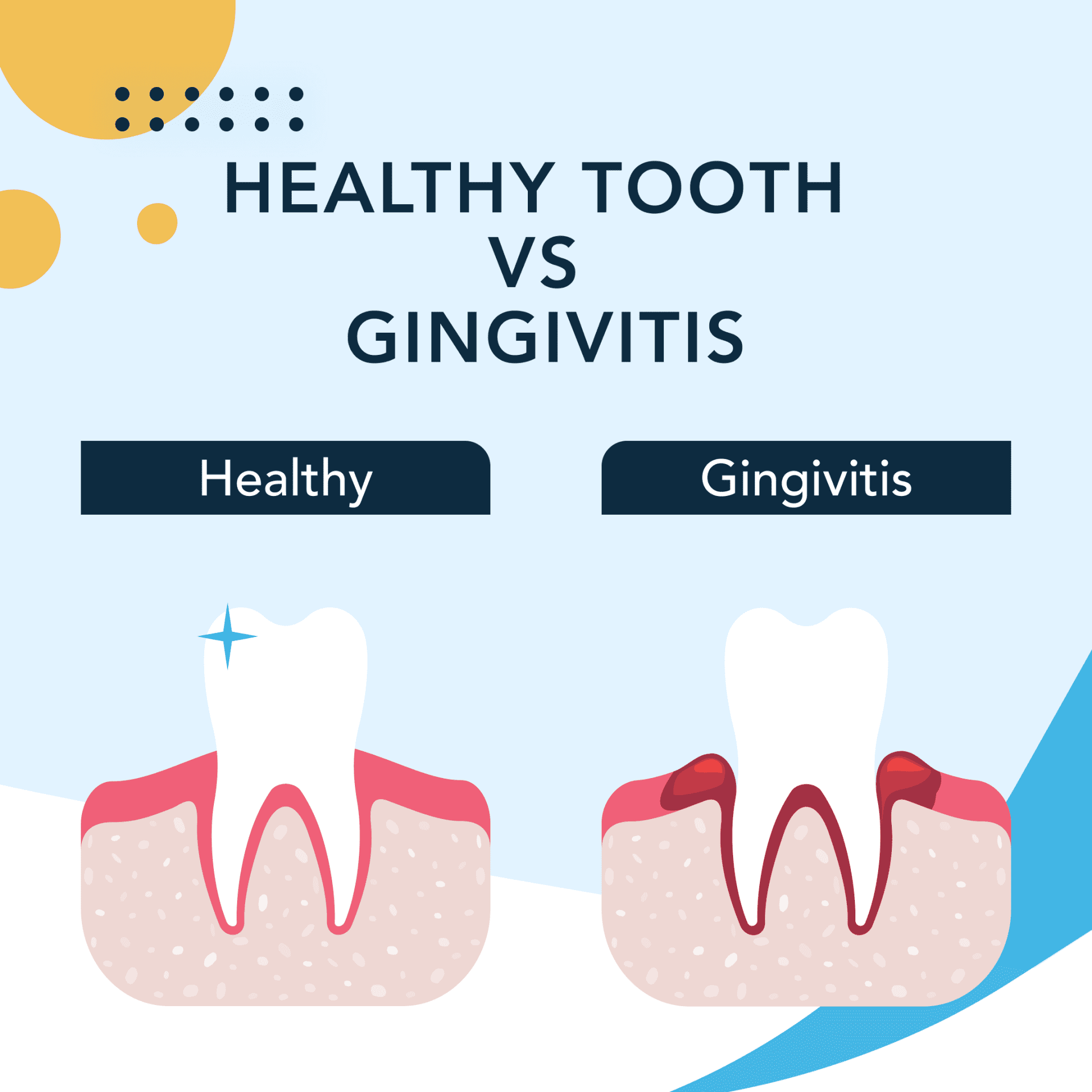Common Gum Diseases & How to Treat Them - Smile Every Day Dentistry