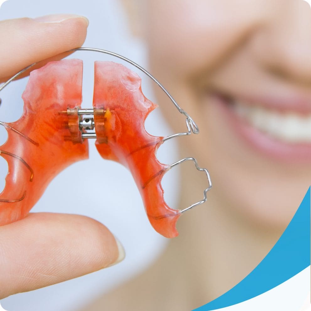Removable vs. Permanent Retainers - Smile Every Day Dentistry