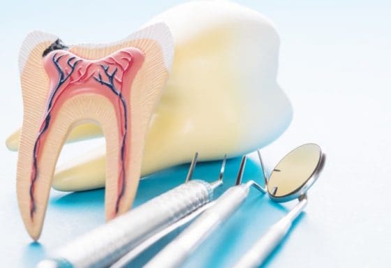 Root Canals Explained - Smile Every Day Dentistry
