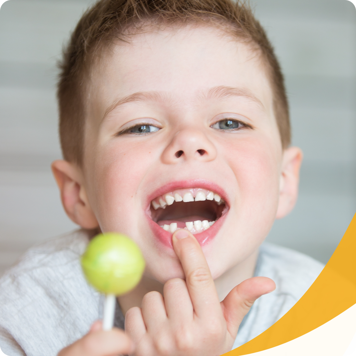 What Causes Tooth Eruption Delay in Children? - Smile Every Day Dentistry